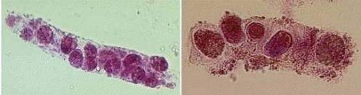 בדיקת שתן כללית - Urinalysis – ויקירפואה
