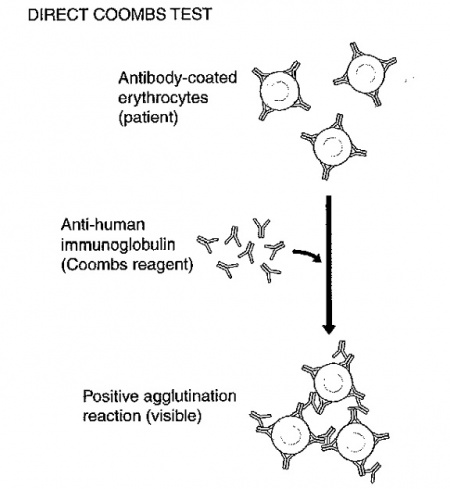מבחן קומבס - Coombs test – ויקירפואה