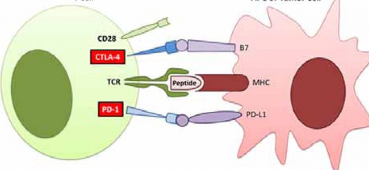 אימונותרפיה בסרטן מעי גס גרורתי - Immunotherapy in metastatic colon ...