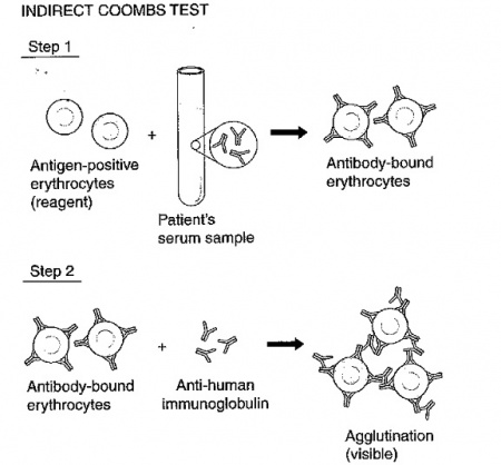 מבחן קומבס - Coombs test – ויקירפואה