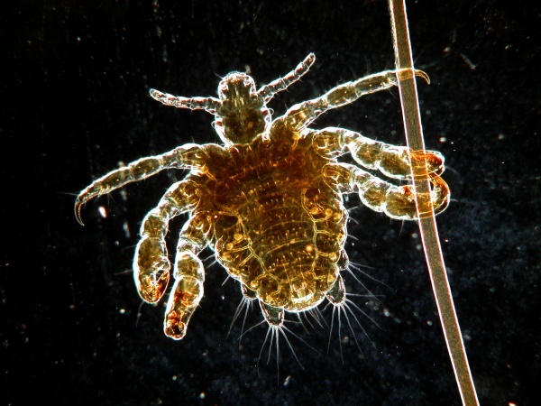 כינמת - Pediculosis – ויקירפואה